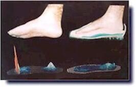 Orthotics | HRSA