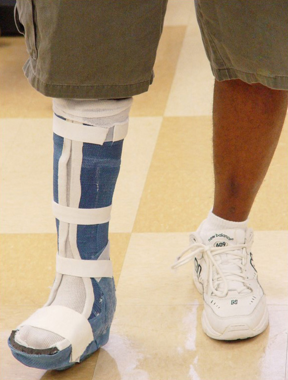Wound Care HRSA Wound Care HRSA